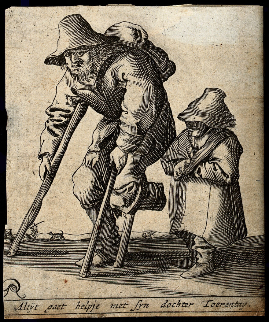A History of Disability in England | Liverpool University Press Blog